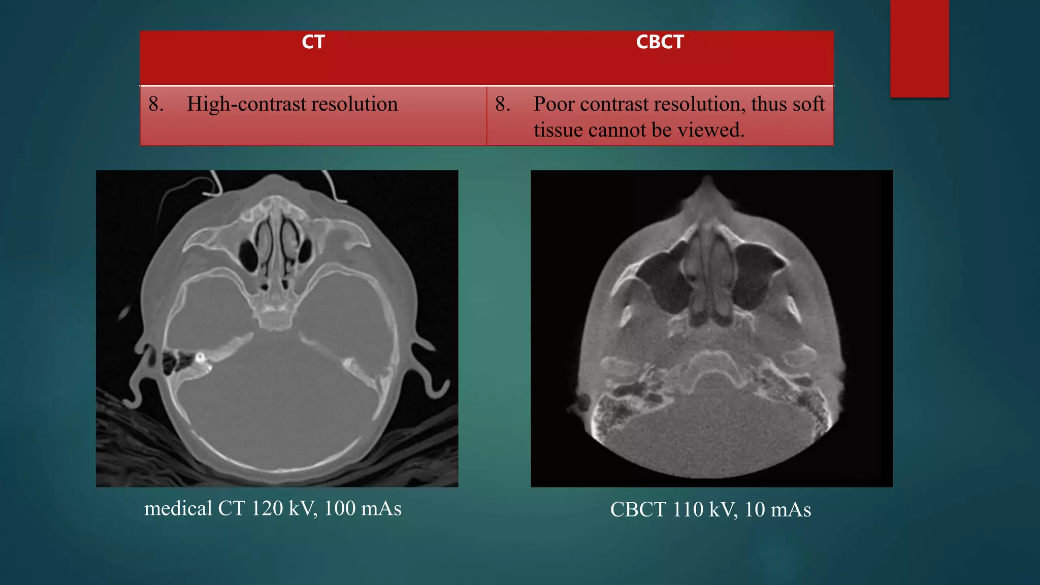 Comparison of ct and cbct | PPTX