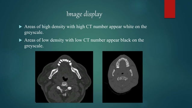 Comparison of ct and cbct | PPTX | 3-D Graphics | Computer Software and ...