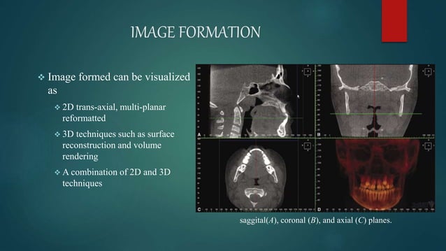 Comparison of ct and cbct | PPTX | 3-D Graphics | Computer Software and Applications
