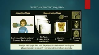 Comparison of ct and cbct | PPTX