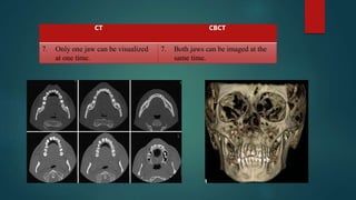 Comparison of ct and cbct | PPTX