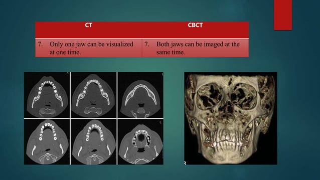 Comparison of ct and cbct | PPT