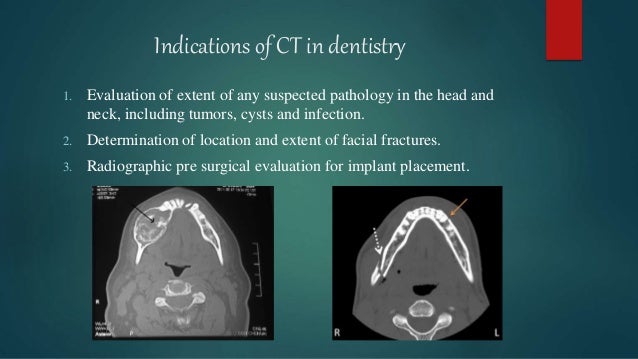 Comparison of ct and cbct