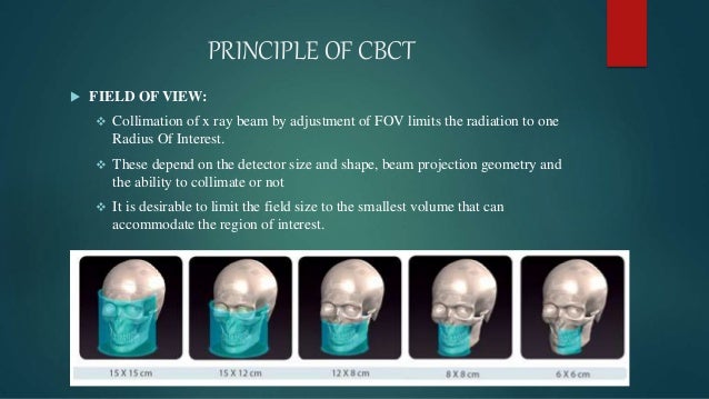 Comparison of ct and cbct