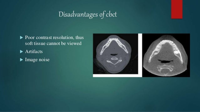 Comparison of ct and cbct