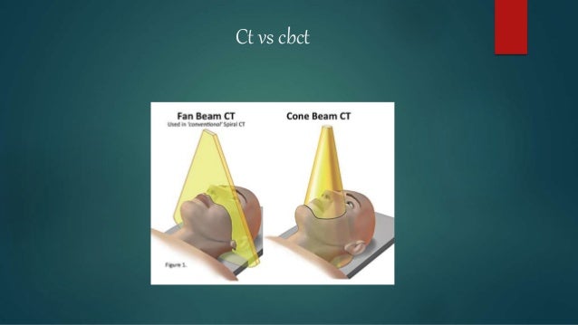 Comparison of ct and cbct