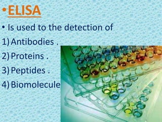 Comparison of hormonal assay by ELISA , ELFA and ECL | PPTX