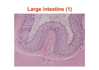 Large Intestine Slide Labeled