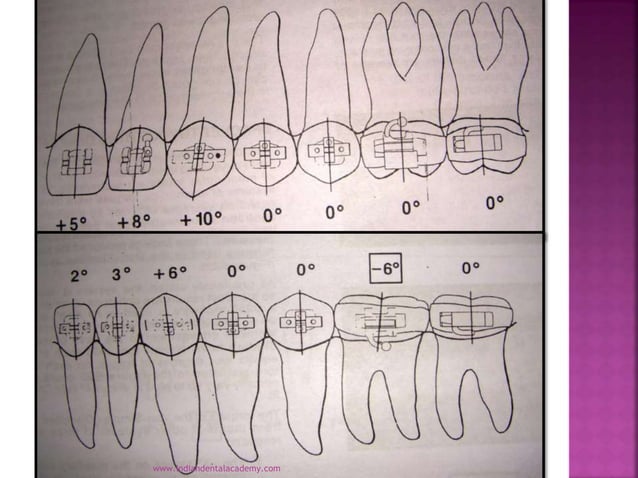 Comparison of The Roth prescription,Alexander prescription & MBT ...