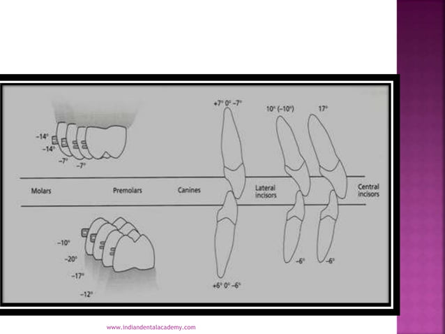 Comparison of The Roth prescription,Alexander prescription & MBT ...