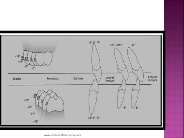 Comparison of The Roth prescription,Alexander prescription & MBT pres…