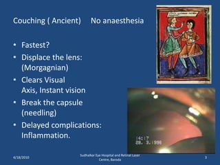 Comparison of various cataract surgical techniques 2 | PPTX | Eye and ...
