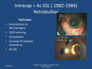 Comparison of various cataract surgical techniques 2 | PPTX | Eye and ...