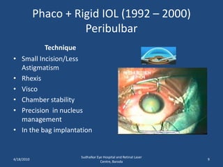Comparison of various cataract surgical techniques 2 | PPTX | Eye and ...