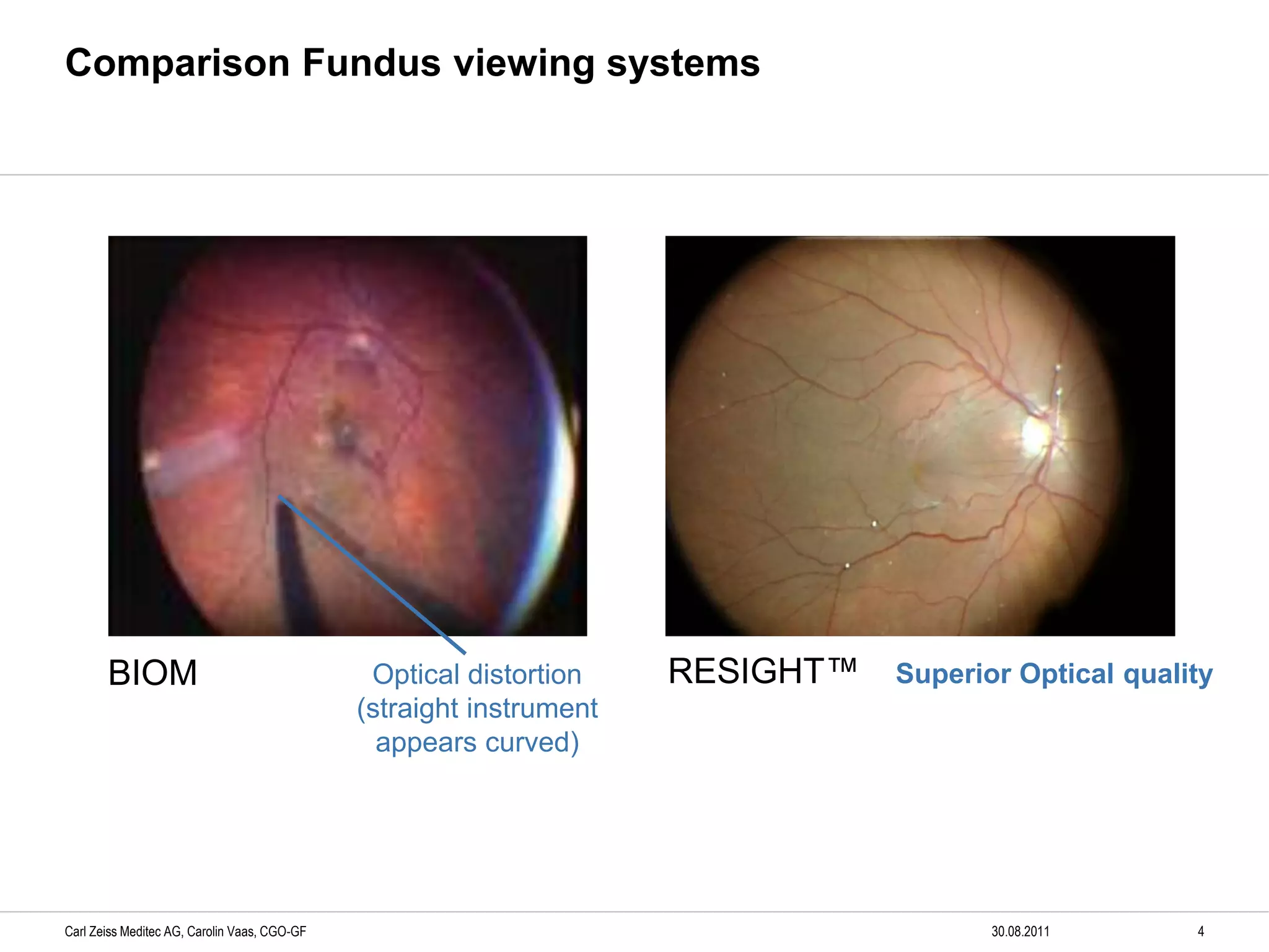 Comparison resight AND OTHER_fundus_viewing SYSTEMS-DR AJAY DUDANI | PPT