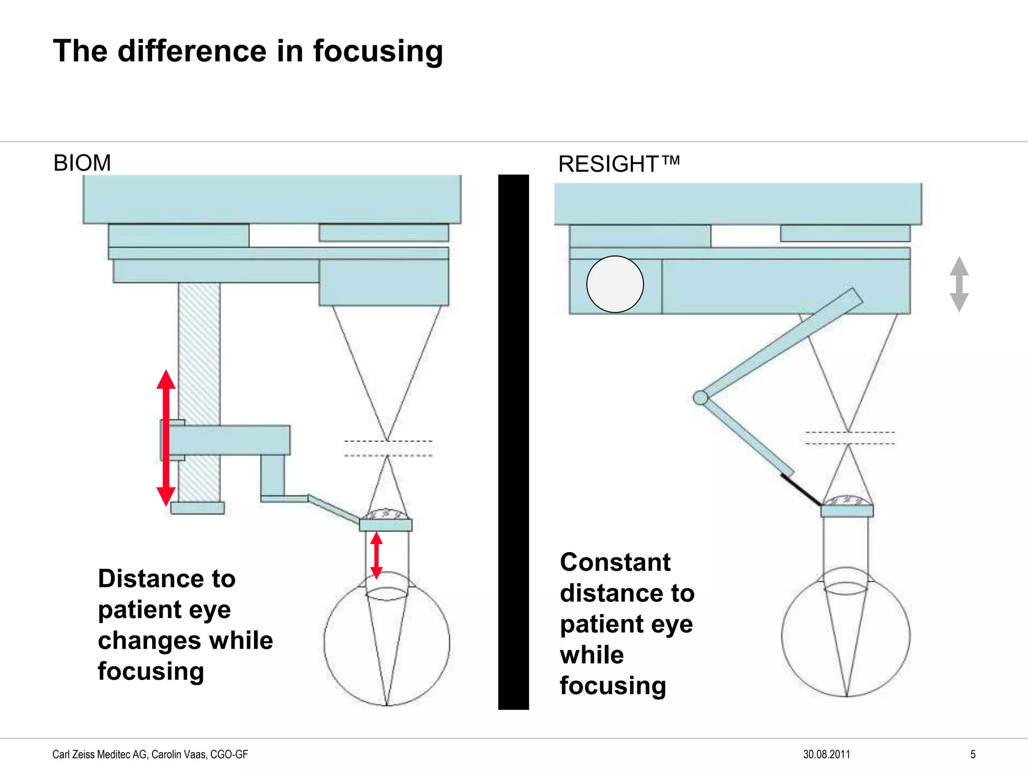 Comparison resight AND OTHER_fundus_viewing SYSTEMS-DR AJAY DUDANI | PPT