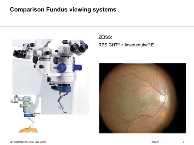 Comparison resight AND OTHER_fundus_viewing SYSTEMS-DR AJAY DUDANI ...