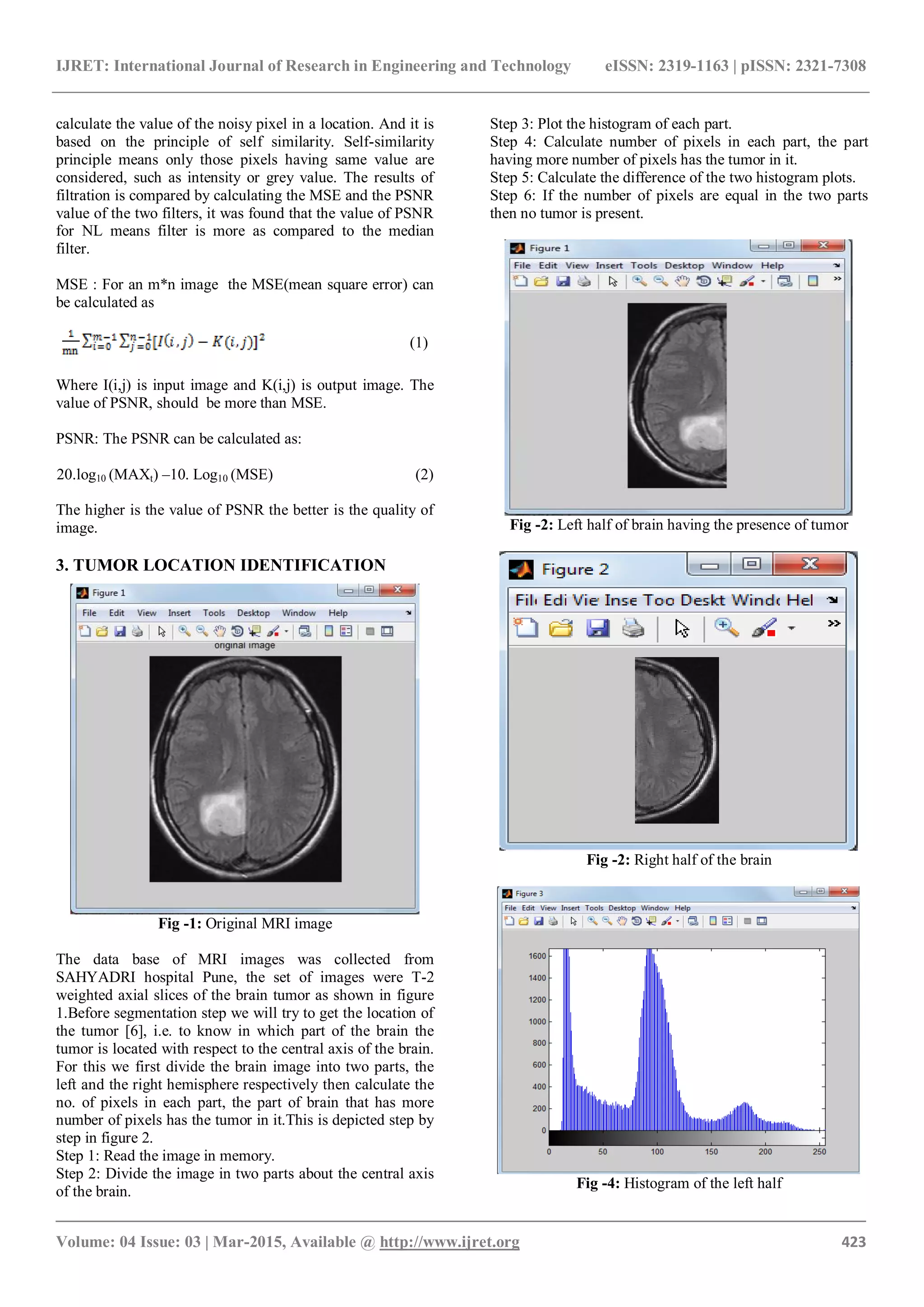 Comparitive study of brain tumor detection using morphological operators | PDF | Photo Editing ...