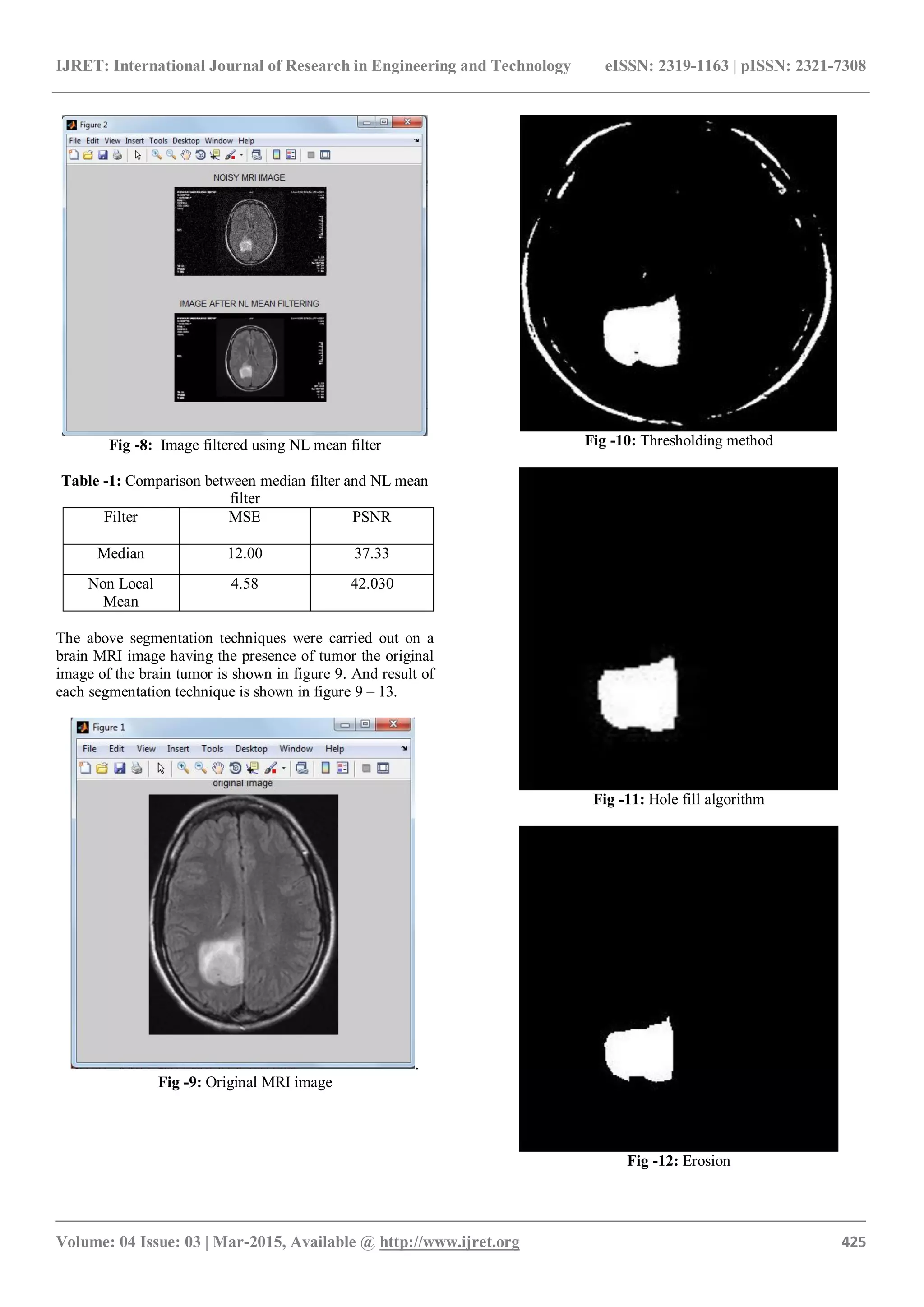 Comparitive study of brain tumor detection using morphological operators | PDF | Photo Editing ...