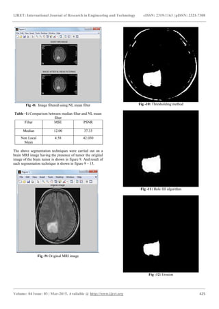 Comparitive study of brain tumor detection using morphological operators | PDF | Photo Editing ...
