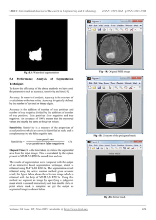 Comparitive study of brain tumor detection using morphological operators | PDF | Photo Editing ...