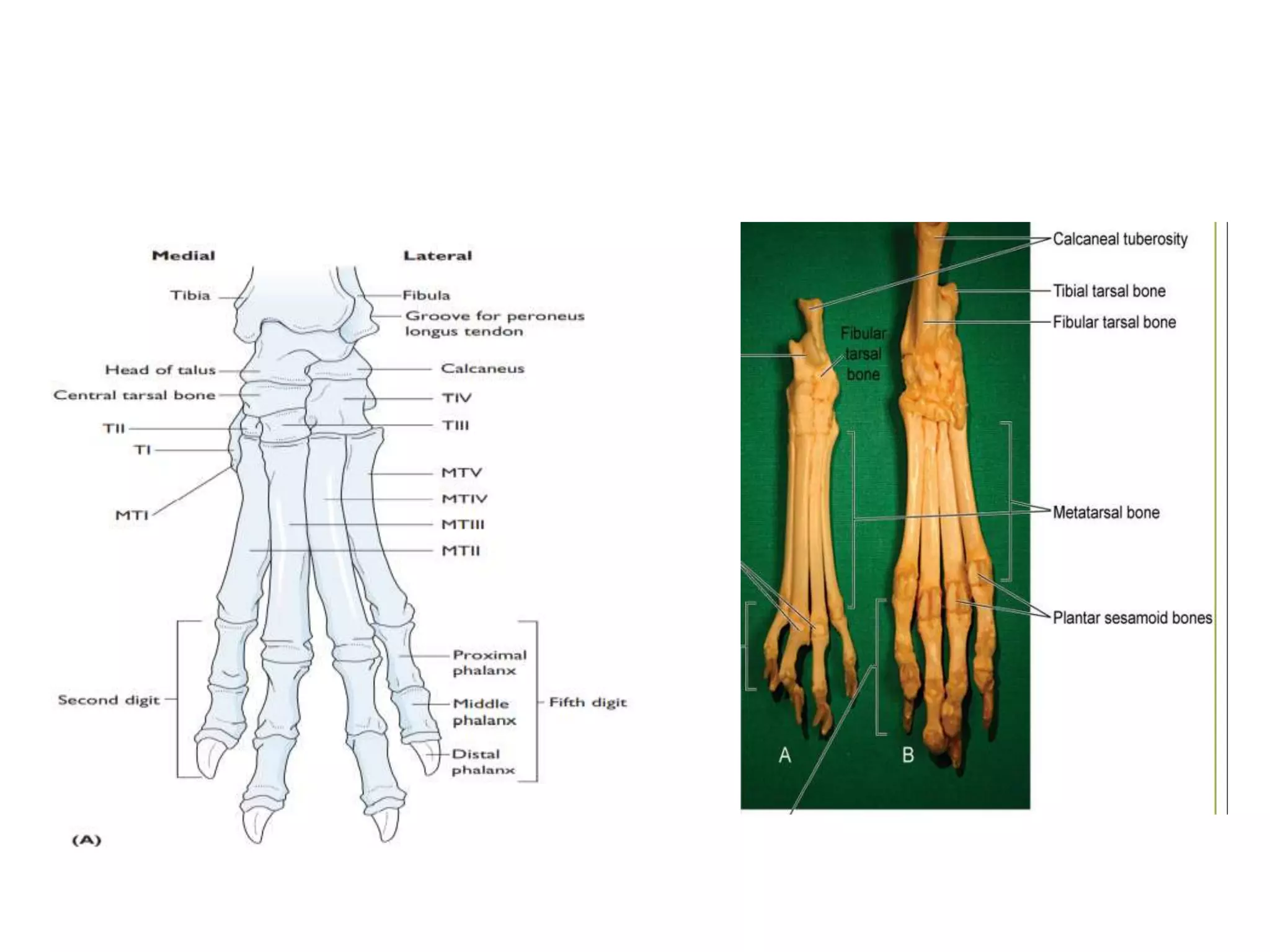 Comparitive Anatomy of Metatarsal bones in different animals.pptx