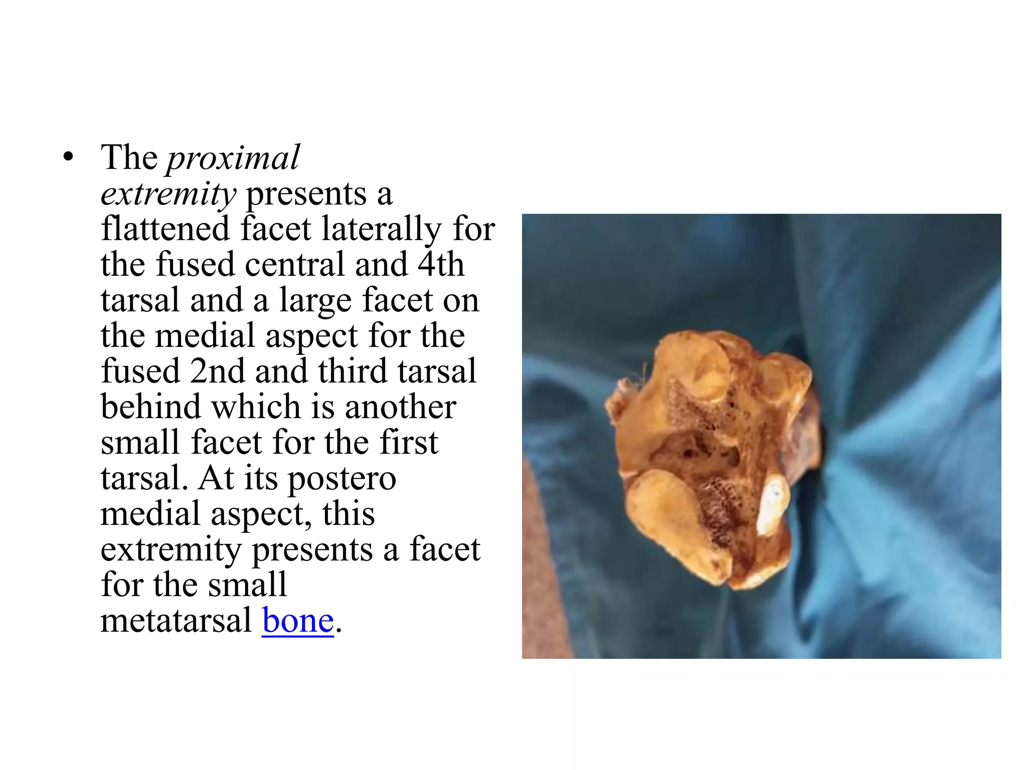 Comparitive Anatomy of Metatarsal bones in different animals.pptx