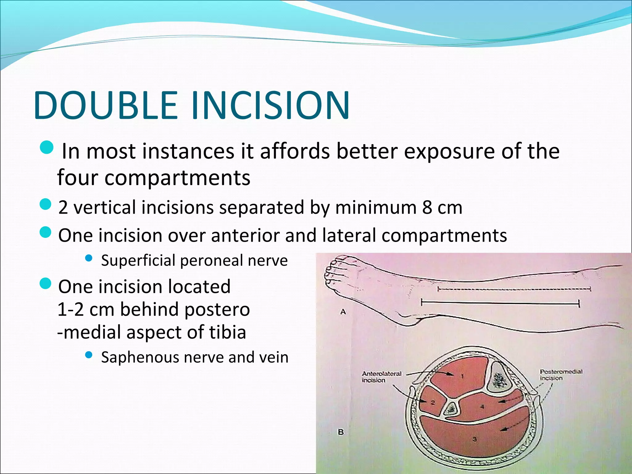 Compartment syndrome basics | PPT