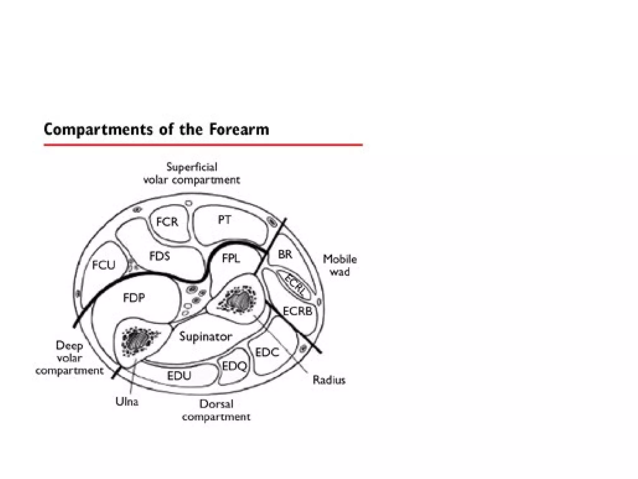 Compartment syndrome | PPT
