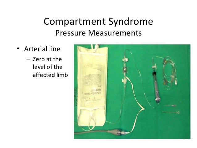 Compartment syndrome