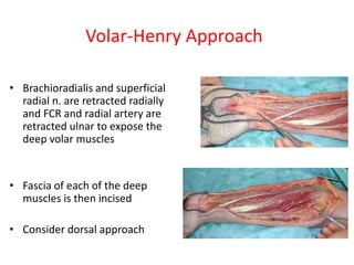 Compartment syndrome | PPT