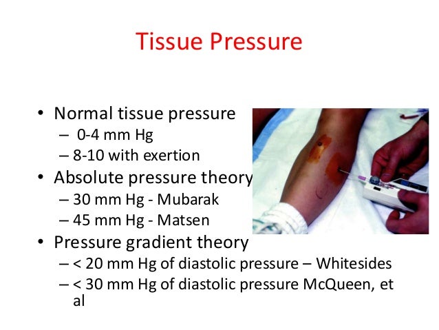 Compartment syndrome