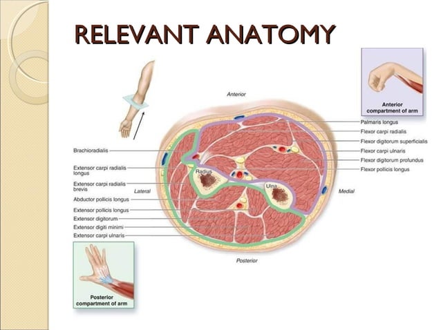 Acute Compartment syndrome | PPT | Physical Therapy | Wellness