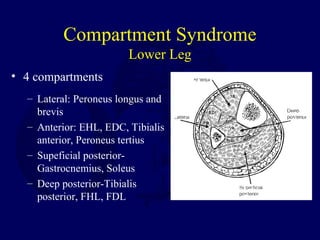 Compartment syndrome | PPT