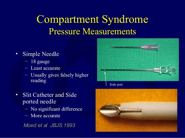 Compartment syndrome