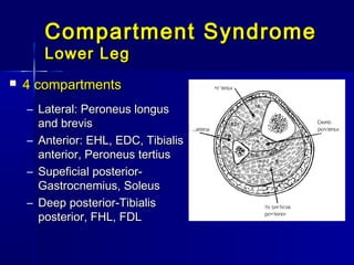 Compartment syndrome | PPT