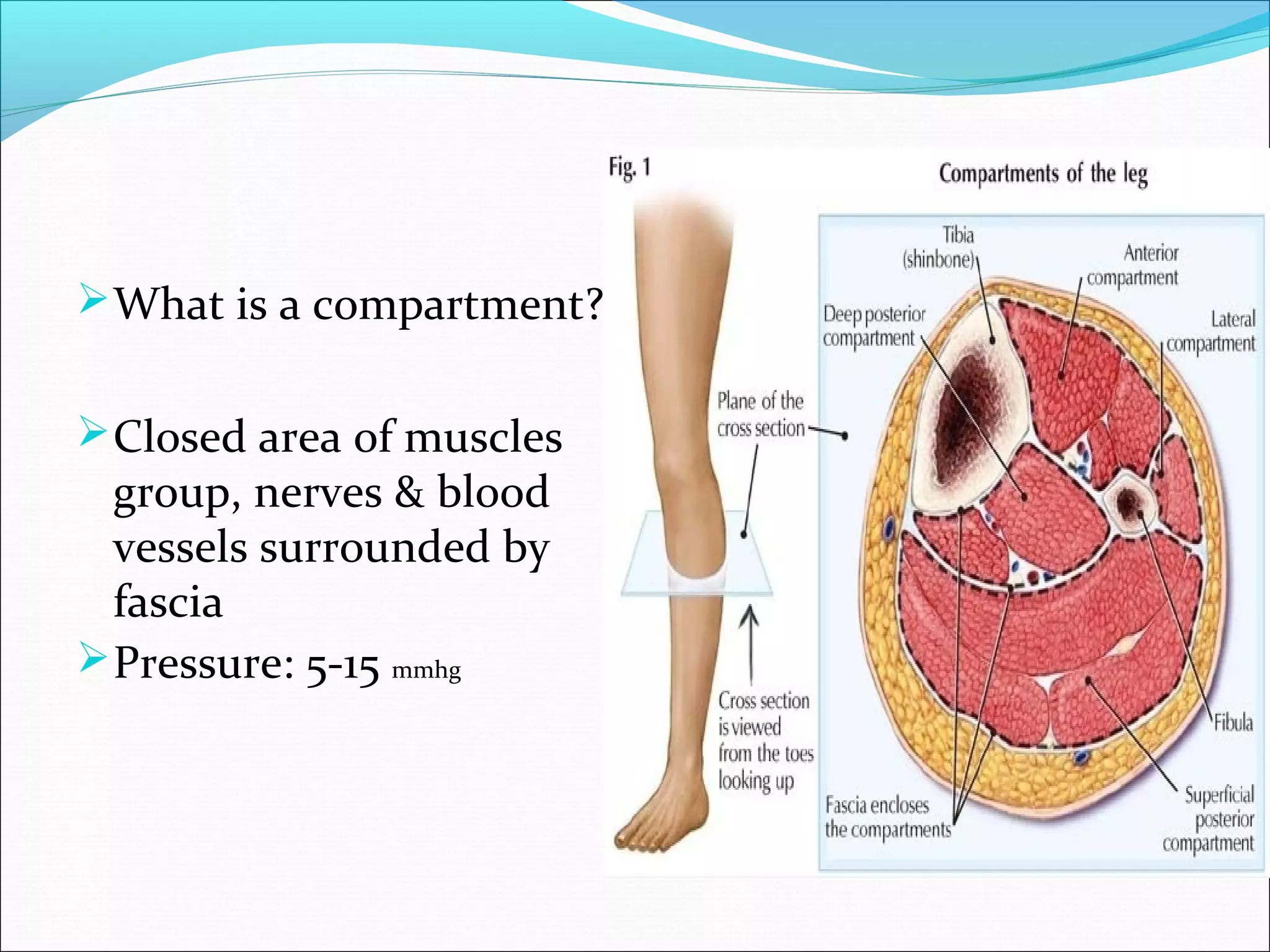 Compartment syndrome | PPT