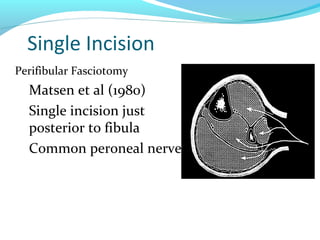 Compartment syndrome | PPT