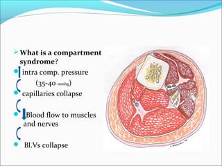 Compartment syndrome | PPT