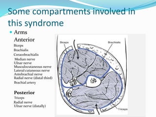 Compartment syndrome | PPTX