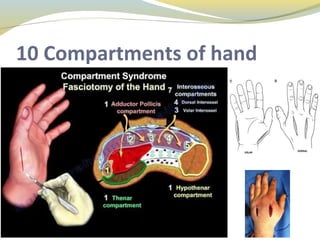 Compartment syndrome | PPT