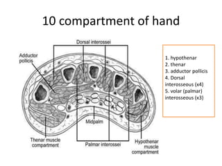 Compartment syndrome | PPTX