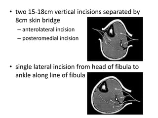 Compartment syndrome | PPTX
