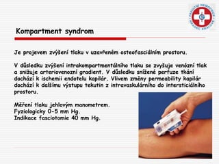 Compartment syndrome | PPTX