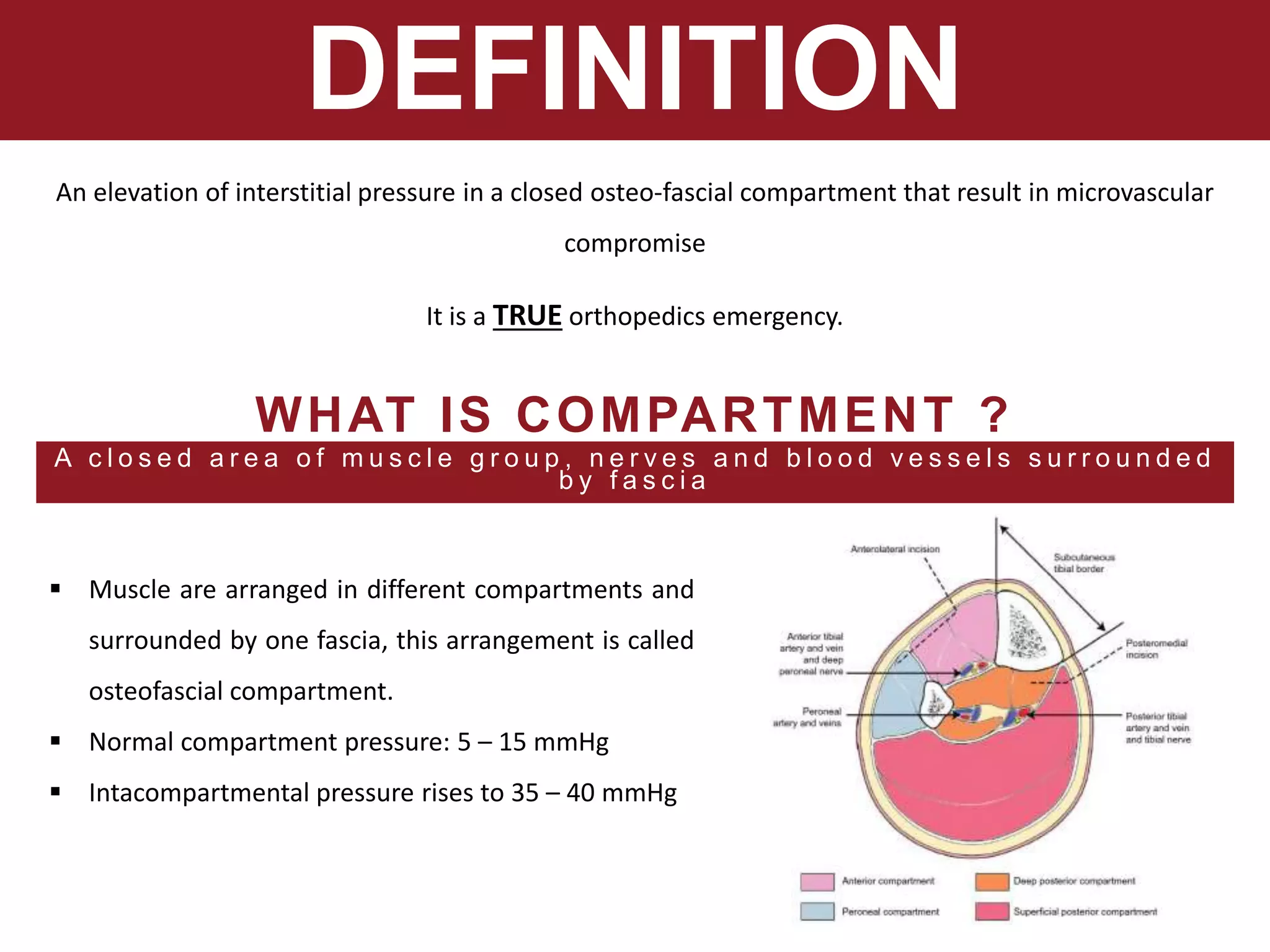 Compartment syndrome | PPTX