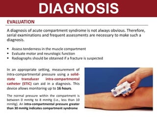 Compartment syndrome | PPTX
