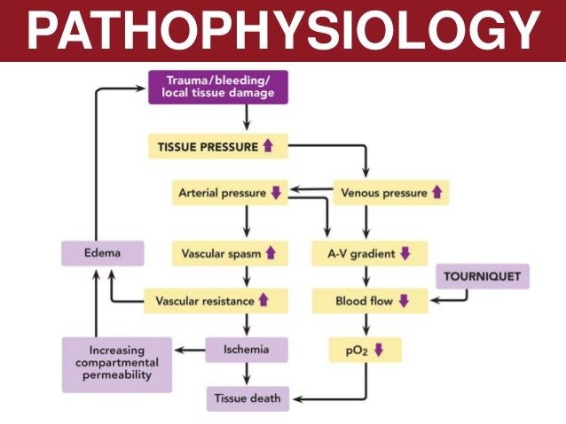 Compartment syndrome