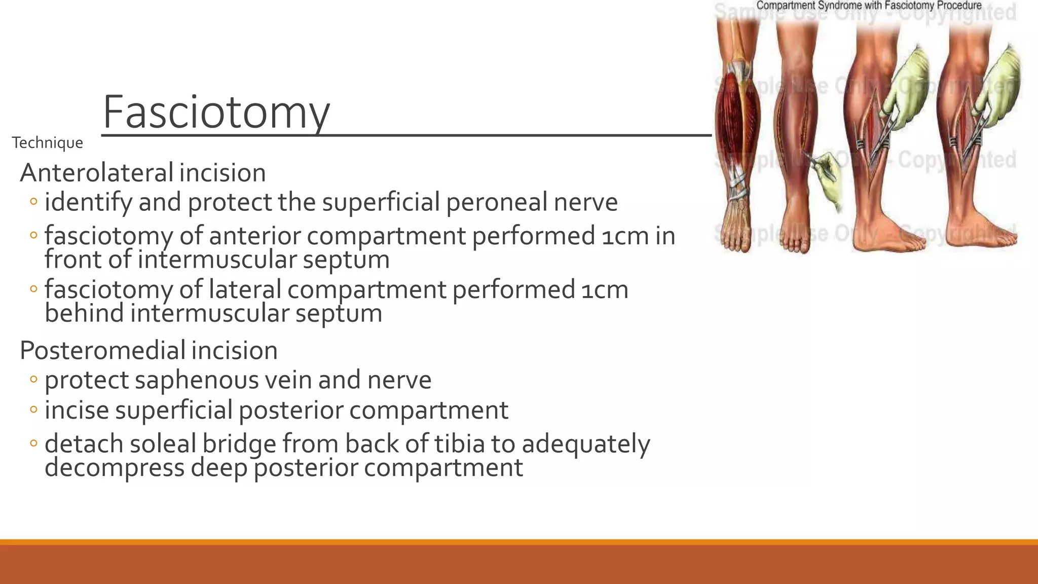 compartment syndrome | PPT
