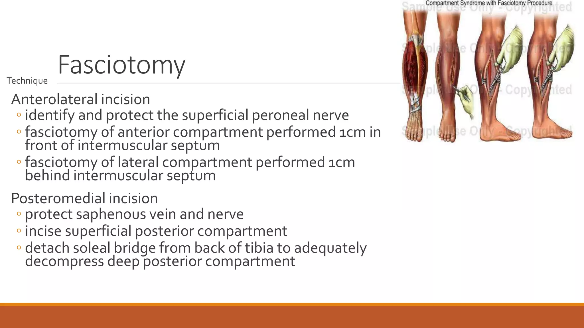 Compartment syndrome | PPTX