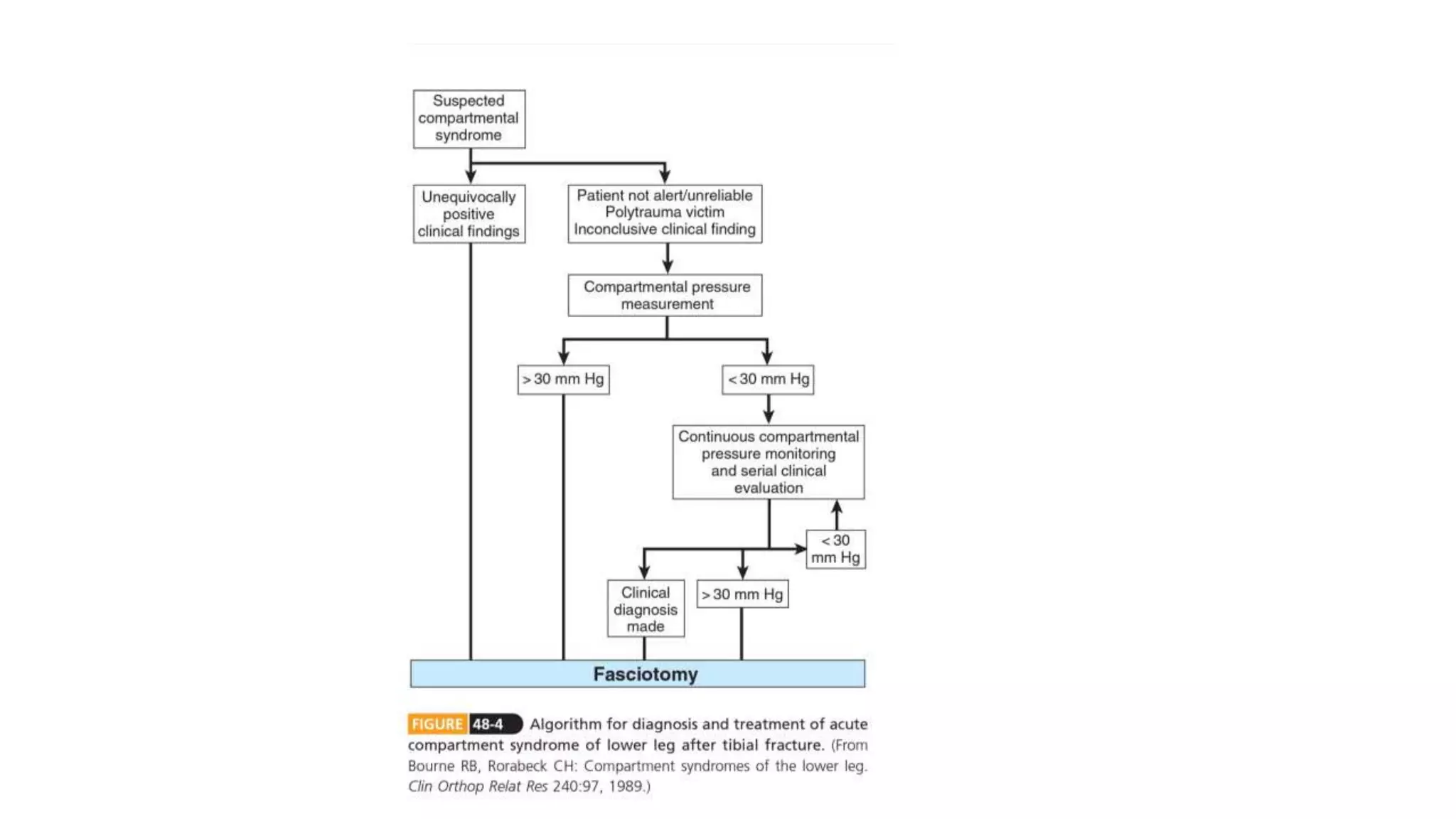 COMPARTMENT SYNDROME | PPTX